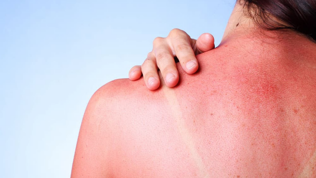 Is Fake Tan Safer Than Sunbaking? What You Need to Know – Custom Tan